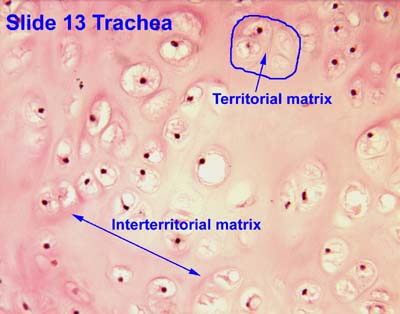 HISTOLOGY PICTURES: Cartilage