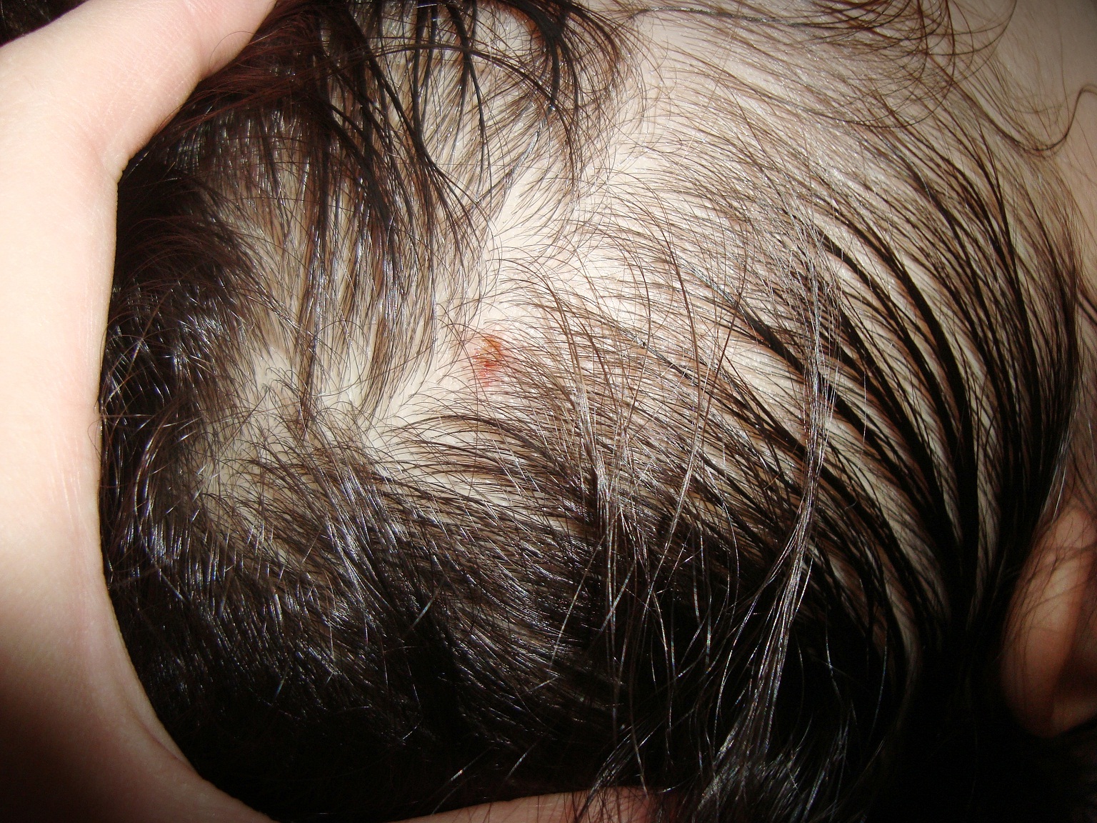 Sam Talks.: Her Busted Lip and Her Wounded Head