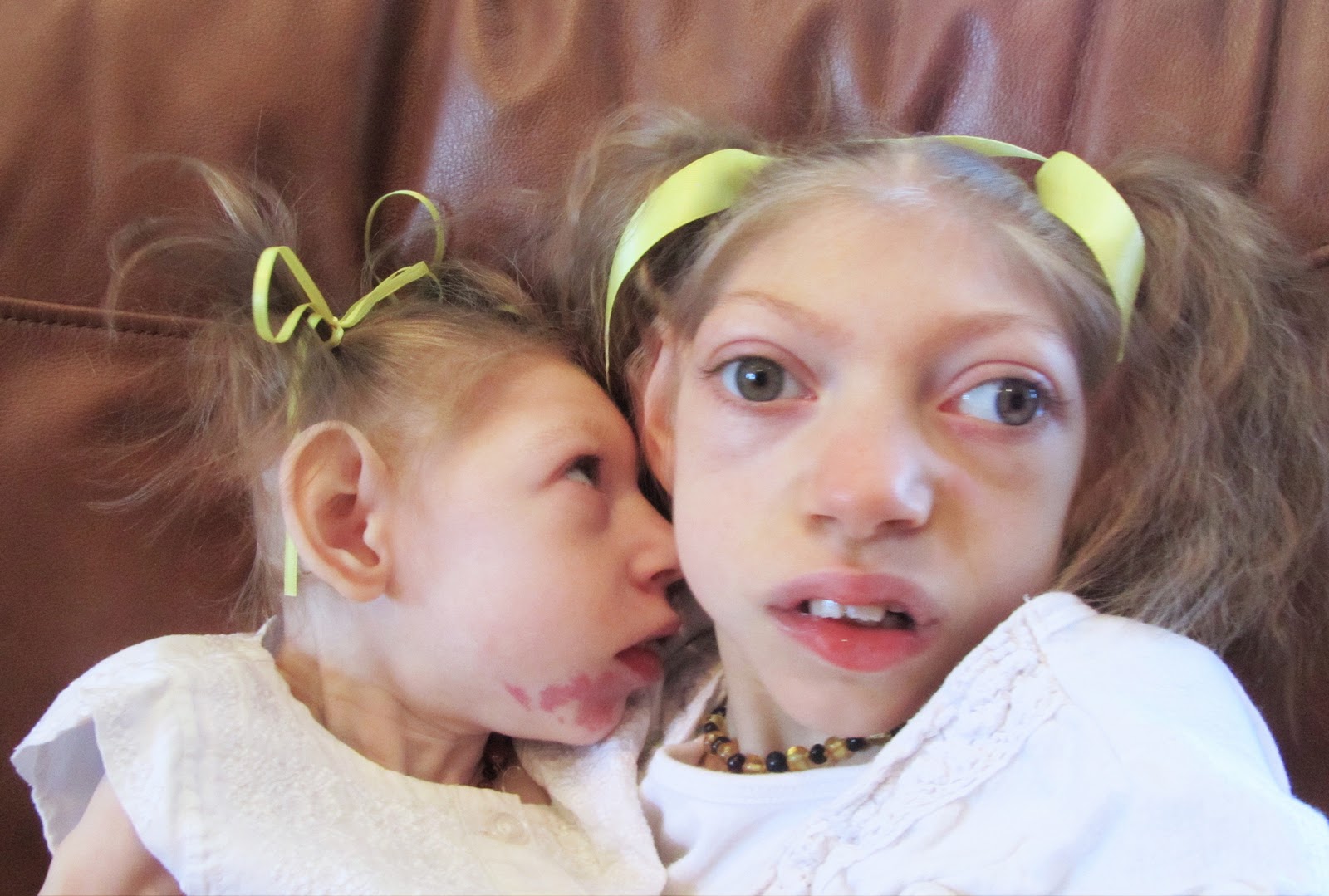 The Hartley Hooligans: Yellow