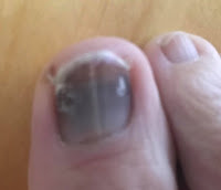 Runderdog: Runleashed and Runstoppable: Marathon recovery: Let's talk ...