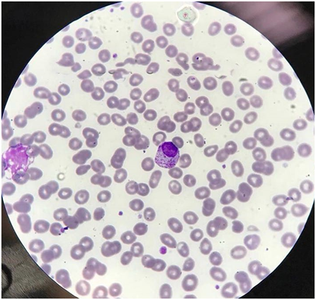 Hematologia Clínica : Atlas de Hematologia