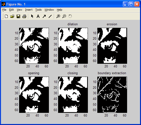 Morphological Operation 1) Opening 2)Closing 3) Erosion 4) Dilation 5 ...