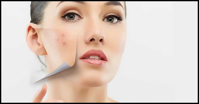 Surprising Reasons For An Acne Breakout | Dr Farrah MD