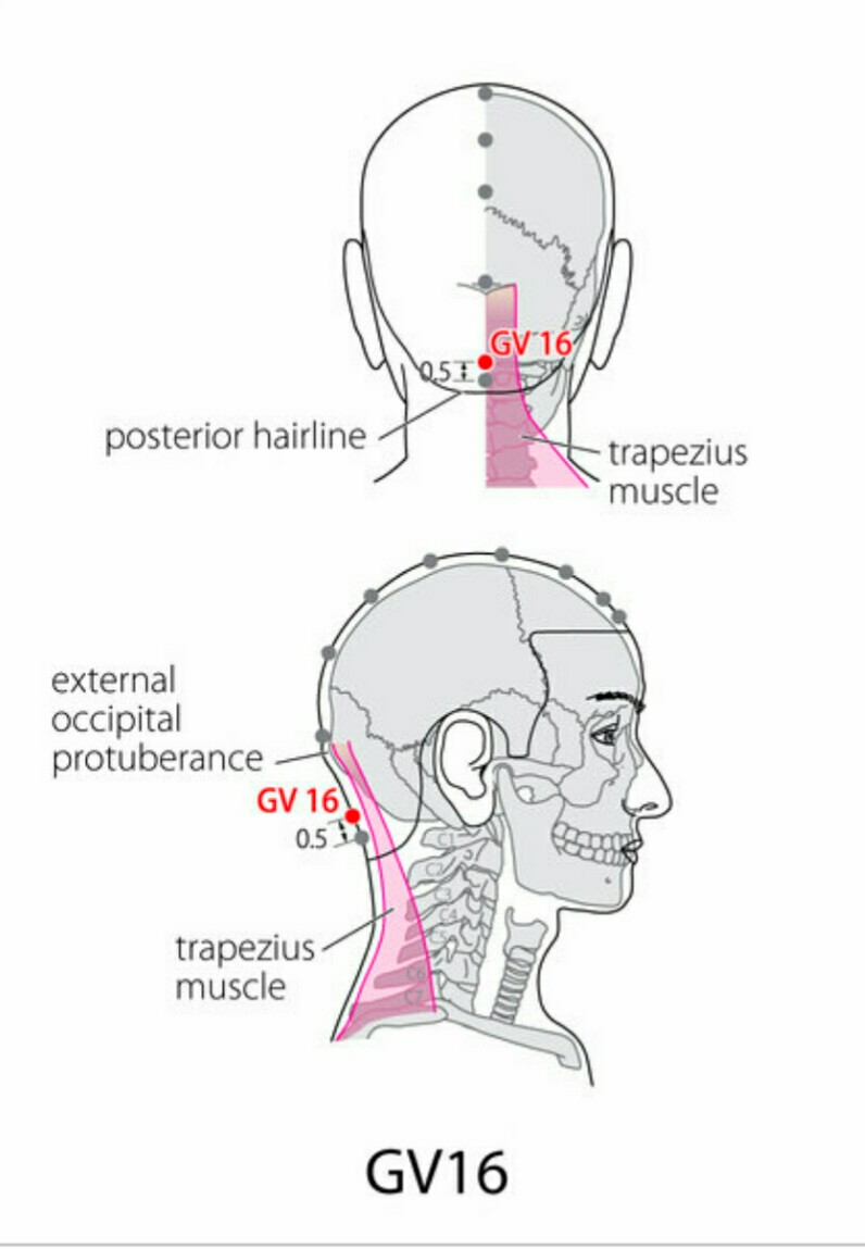 SaroEpic Acupuncture : 2016