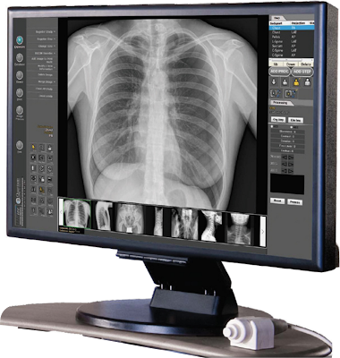 RADIOLOGIA IN FOCO: Sistema de Raios-X Digital