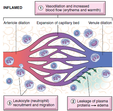 Inflammation | Your Medical Advices