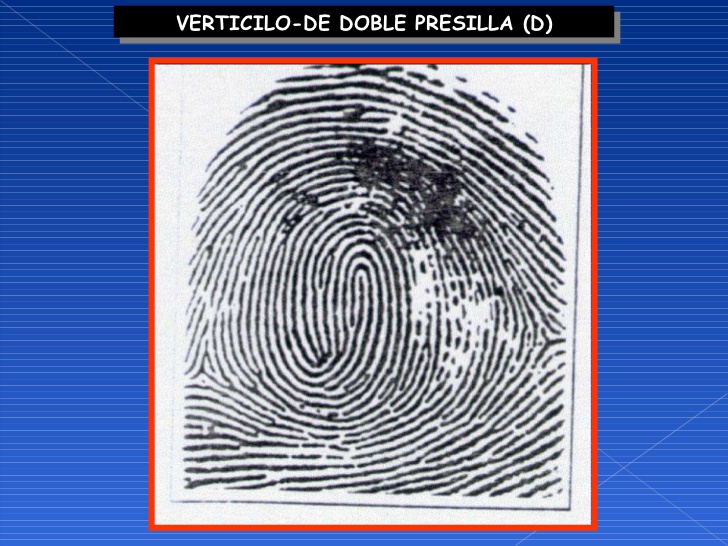 Diferentes Tipos de Dactilogramas