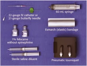 Procedures Club: The Bier Block