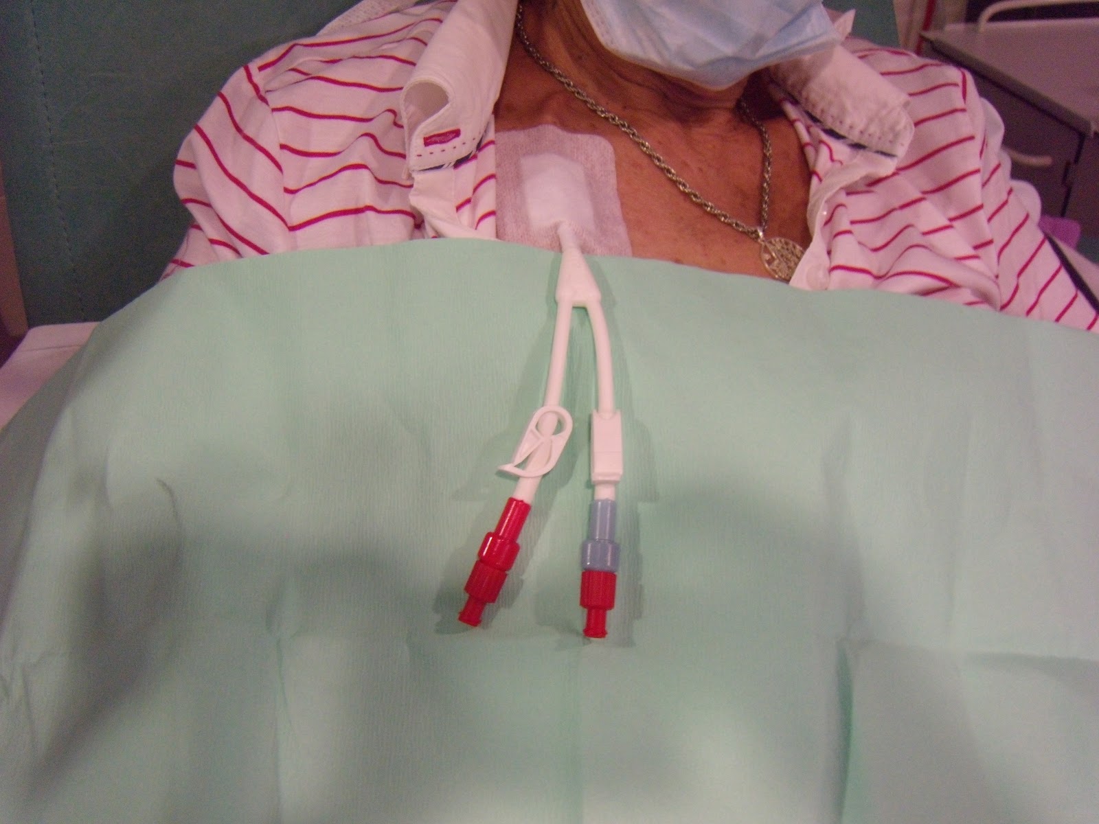 Diálisis, diario para principiantes: Hemodiálisis:Diferencia entre ...