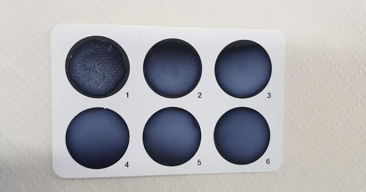 Inmunología: Práctica 1: PCR Latex