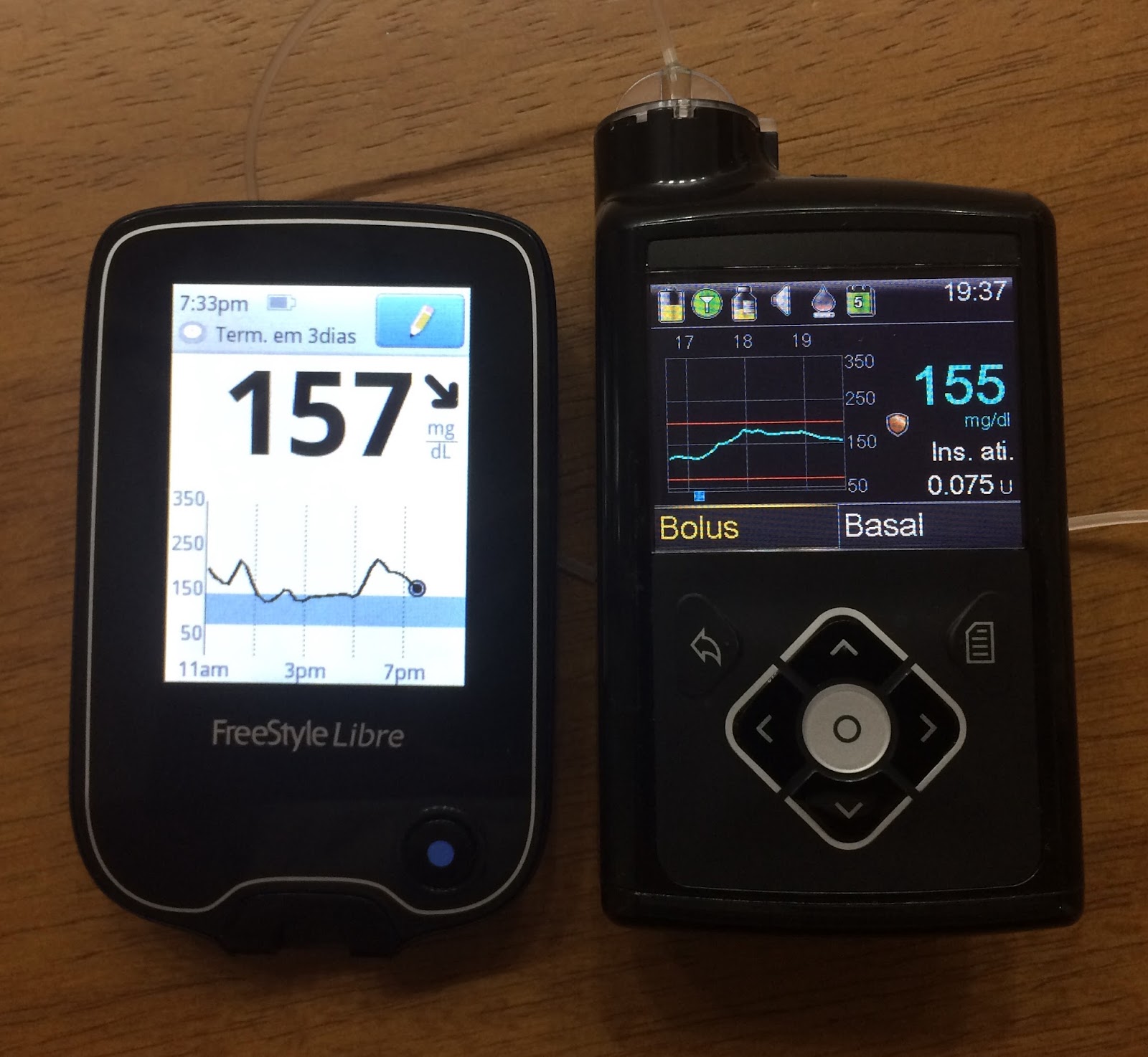 MiniMed 640G: Cena 4 - as primeiras impressões...