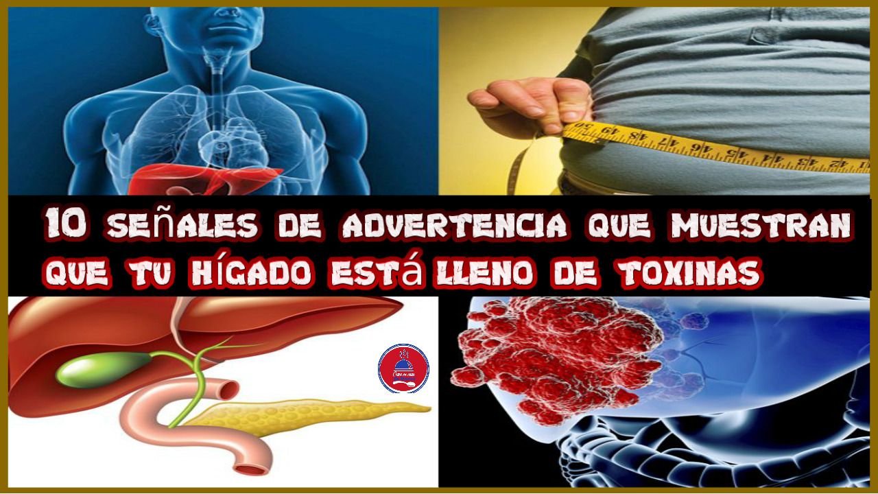 10 señales de advertencia que muestran que tu hígado está lleno de ...