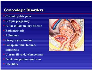 Health: 4 Common Gyn Disorders