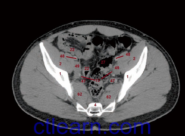 Anatomy CT Axial Abdomen and Pelvis Male