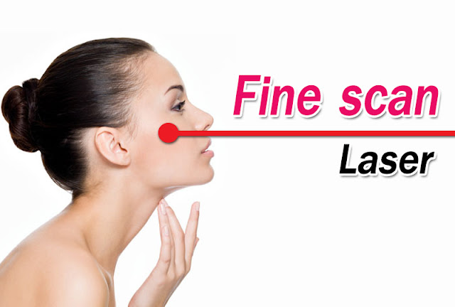 Fine scan เลเซอร์รักษาหลุมสิวราคามิตรภาพ - เลเซอร์รักษาสิว หลุมสิว