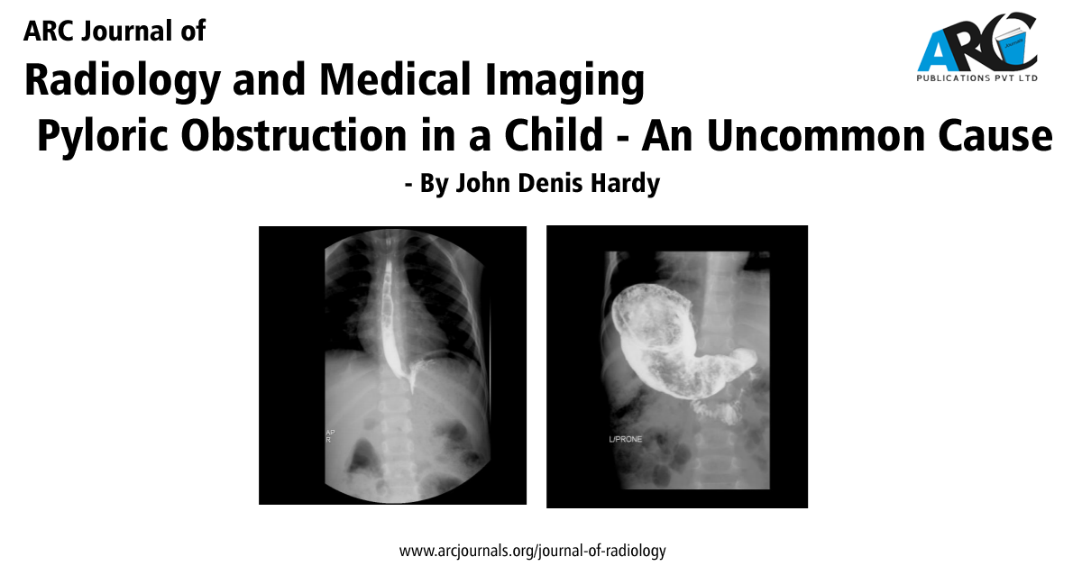 Pyloric Obstruction in a Child - An Uncommon Cause ~ ARC Journals