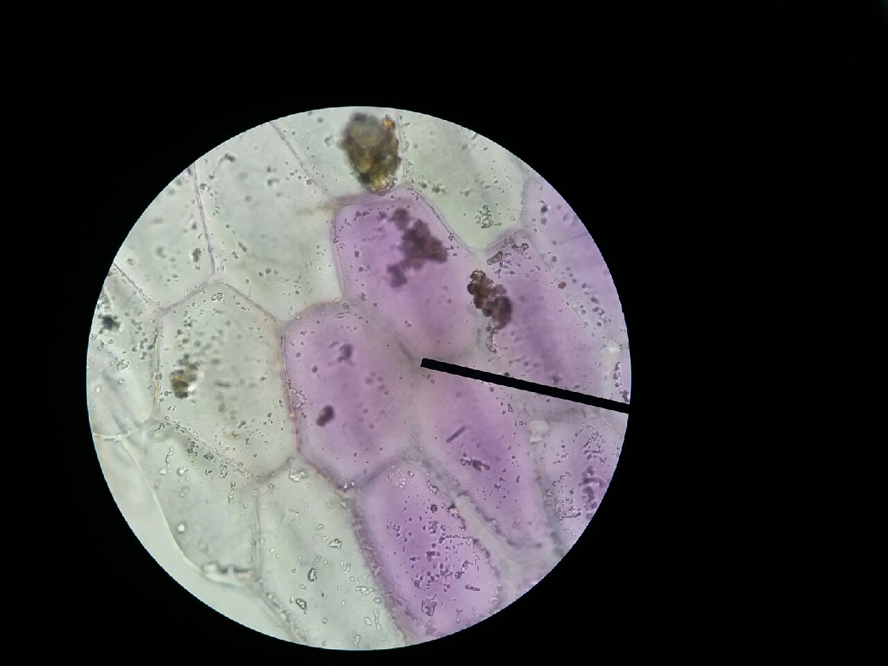 Biology: Penebalan Dinding Sel dan Plasmolisis