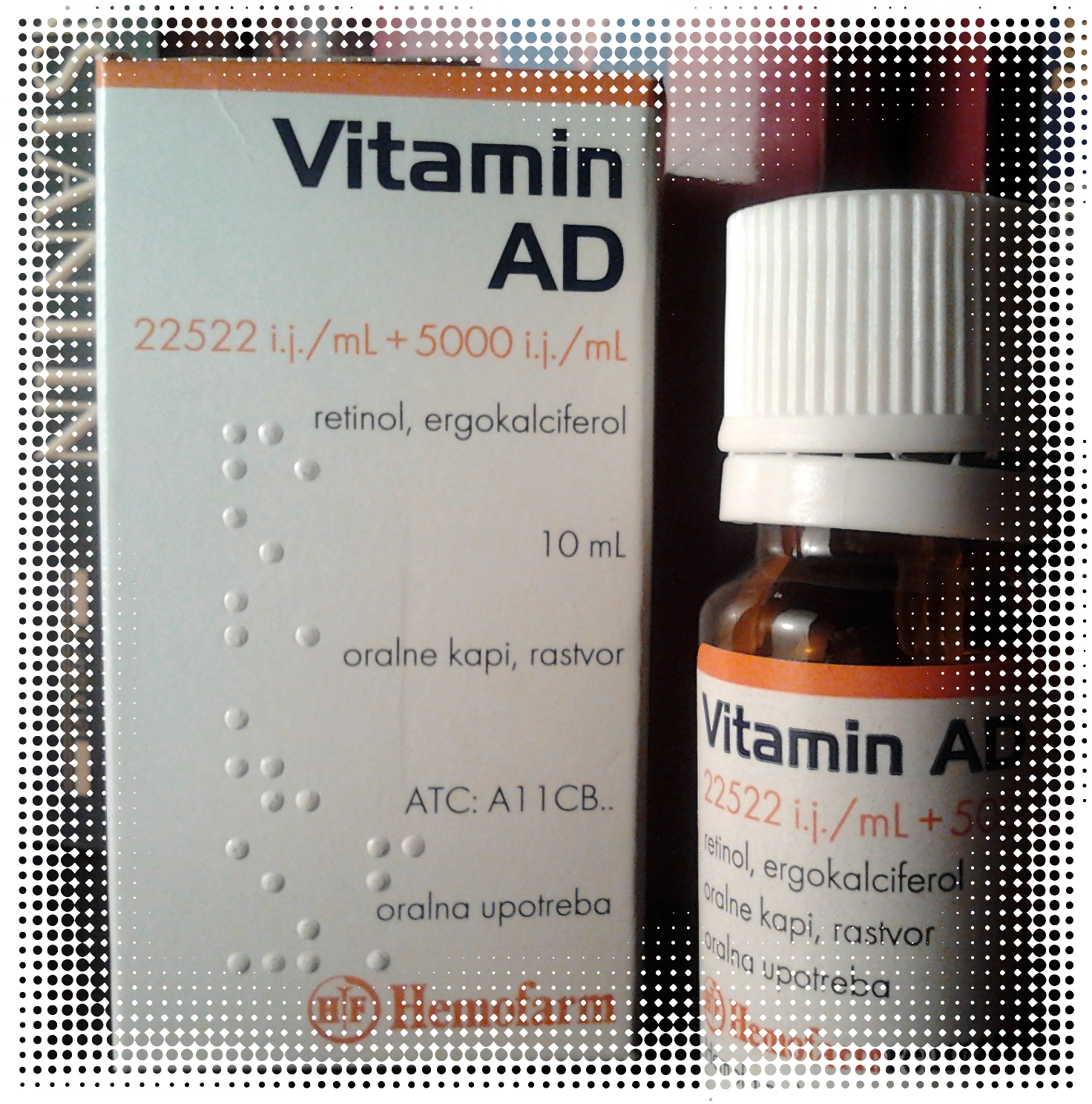 One month after RF Turbinate reduction operation - Empty Nose Syndrome