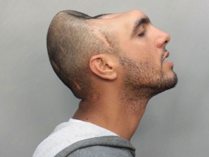 ACCIDENTES DE TRÁNSITO