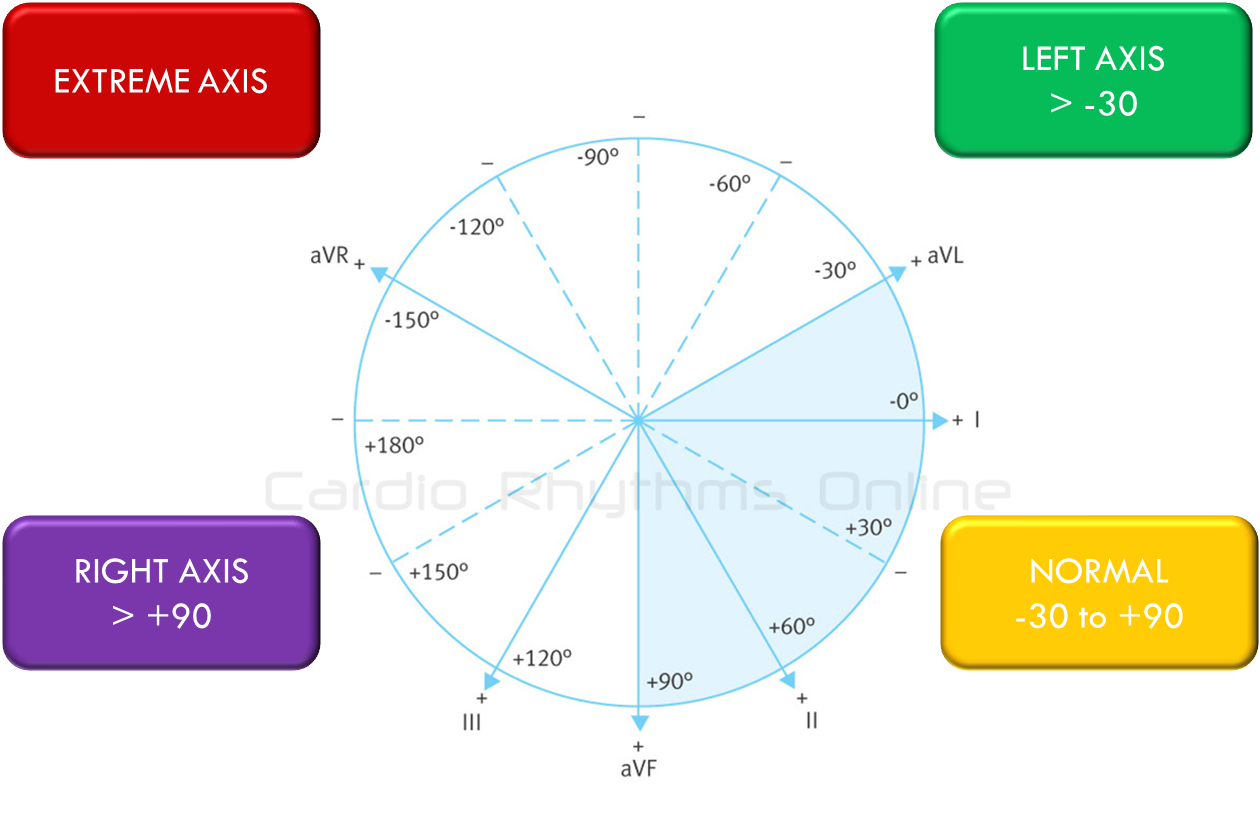 CVT Mohd Farid: ECG Basic:Cardiac Axis-Credit Cardio Rhythm Online Blogspot