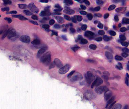 MoyinAdesanyaBiol 3500: The Human Appendix: My Favorite Organ: The ...