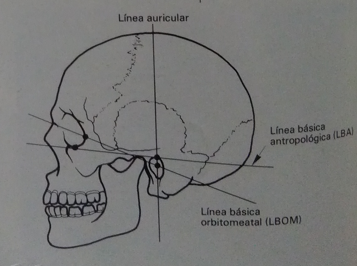PRODUCCIÓN Y TRATAMIENTO DE IMAGENES DIAGNOSTICAS: ATLAS-TOPOGRAFÍA DE ...