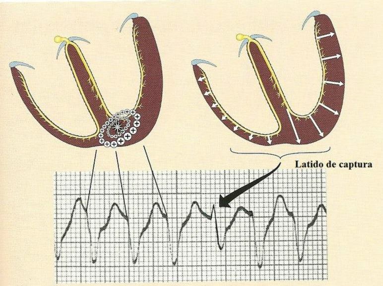Dr. Rafael Soto - Electrocardiografía - Cardiología clínica ...