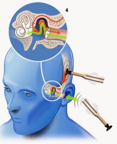 Trialmedics: Prueba de Weber y Rinne