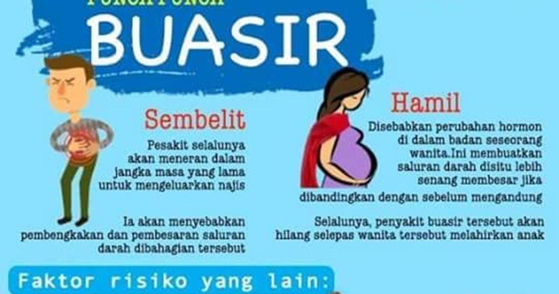 Info Kapsul BUASIR: APA ITU BUASIR