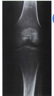 Gambaran Radiograph menurut kualitas gambaran