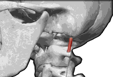 Musculo recto lateral de la cabeza