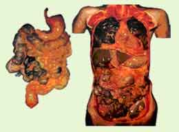 Mengenal toksin ~ Tripavillage