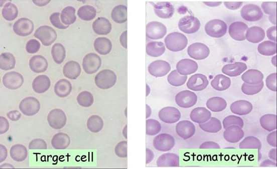 Stomatocyte