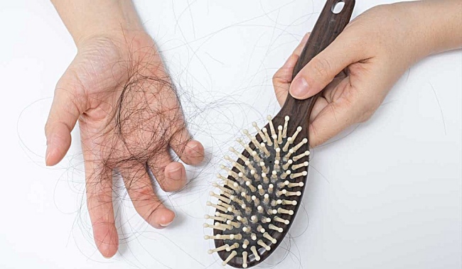 8 PETUA MEMBANTU KURANGKAN RAMBUT GUGUR DENGAN MUDAH
