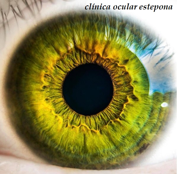 LIPOXINAS y GLAUCOMA