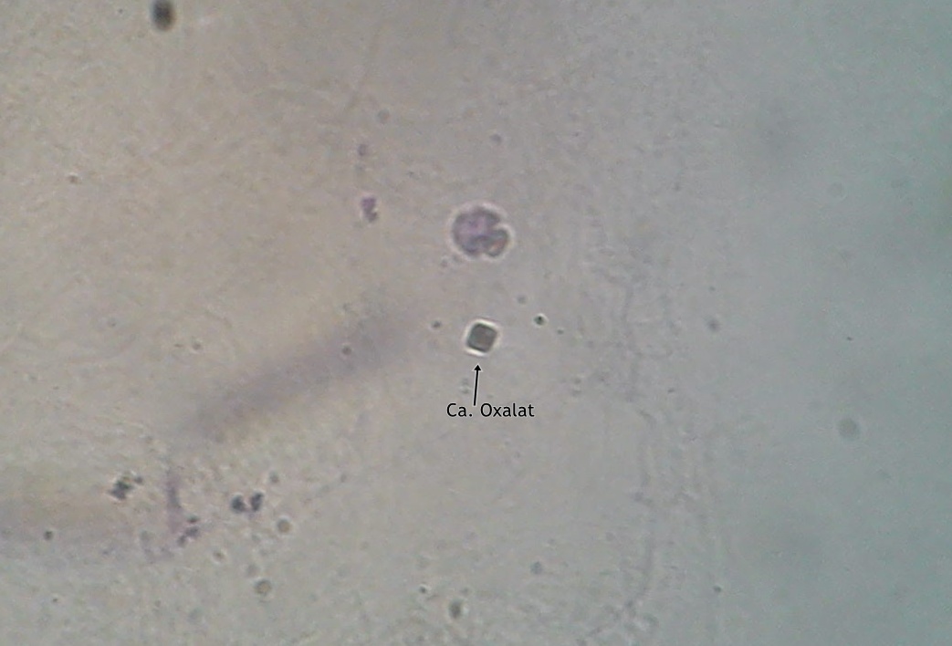 Sedimen Urine (Stainning) | Analis Kesehatan