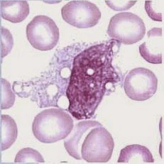Células importantes en hematología: MONOCITO
