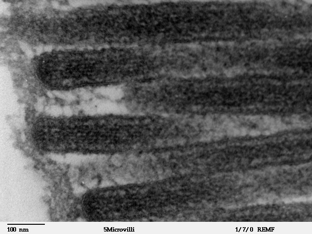 el moderno prometeo: Citoesqueleto: Microfilamentos.