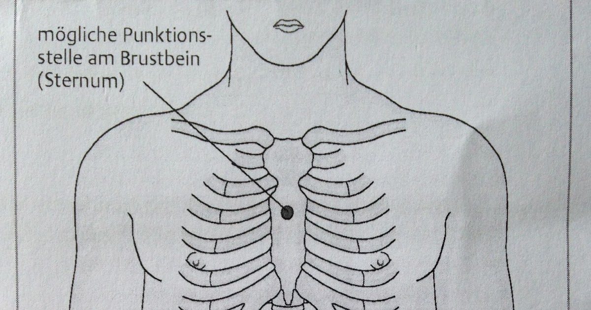 Transplantation und andere Probleme !: Knochenmarkspunktion