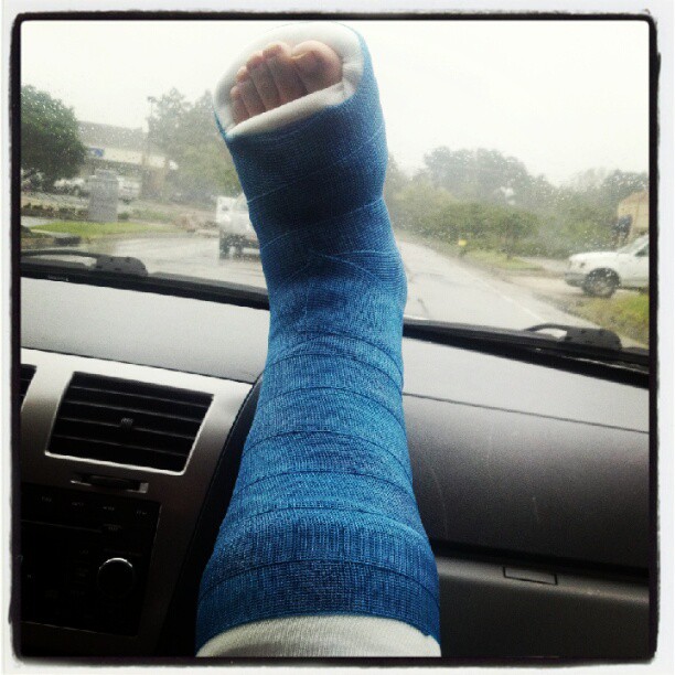 Casts and Toes: Random Assortment of Cast Pics