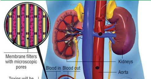 amudu: Development of a surgically implantable, artificial kidney
