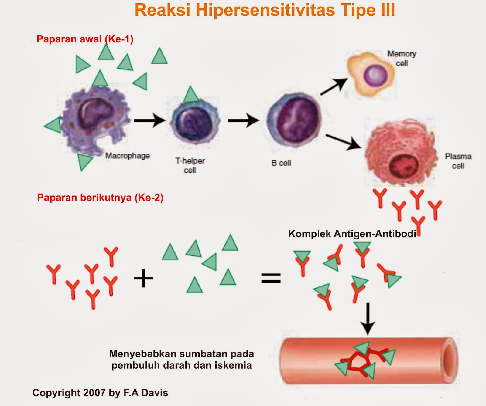 Reaksi Alergi (Hypersensitivity Reaction)