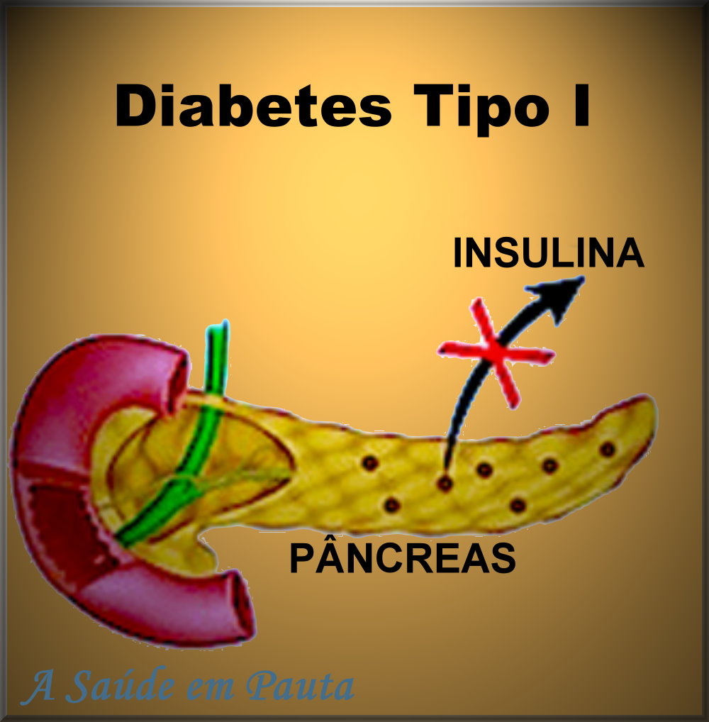 Causas De La Diabetes