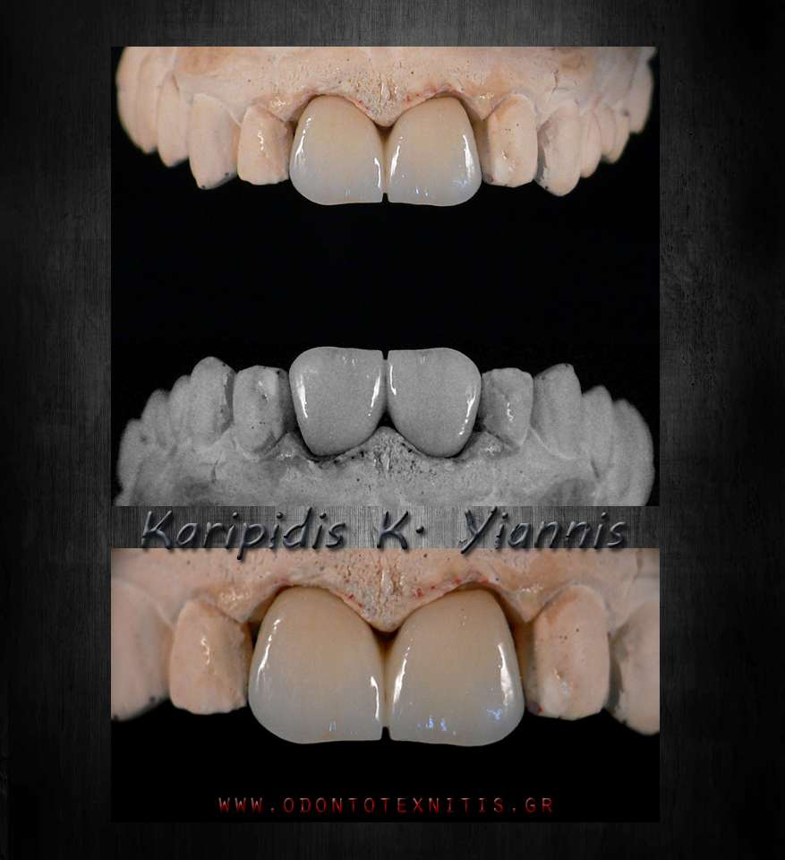 ΑΡΘΡΑ - ΣΚΕΨΕΙΣ - ΦΩΤΟ - ΠΕΡΙΣΤΑΤΙΚΑ ΟΔΟΝΤΙΚΗΣ ΤΕΧΝΟΛΟΓΙΑΣ: 2 unit ...