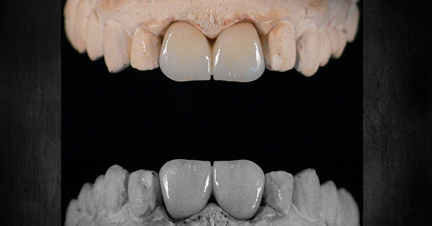 ΑΡΘΡΑ - ΣΚΕΨΕΙΣ - ΦΩΤΟ - ΠΕΡΙΣΤΑΤΙΚΑ ΟΔΟΝΤΙΚΗΣ ΤΕΧΝΟΛΟΓΙΑΣ: 2 unit ...