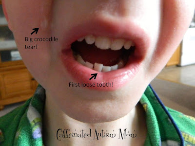 Caffeinated Autism Mom: Wordless Wednesday: Toothy Milestone