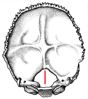 Asymmetry of the Modern Human Endocranium: Placing the fixed landmarks ...