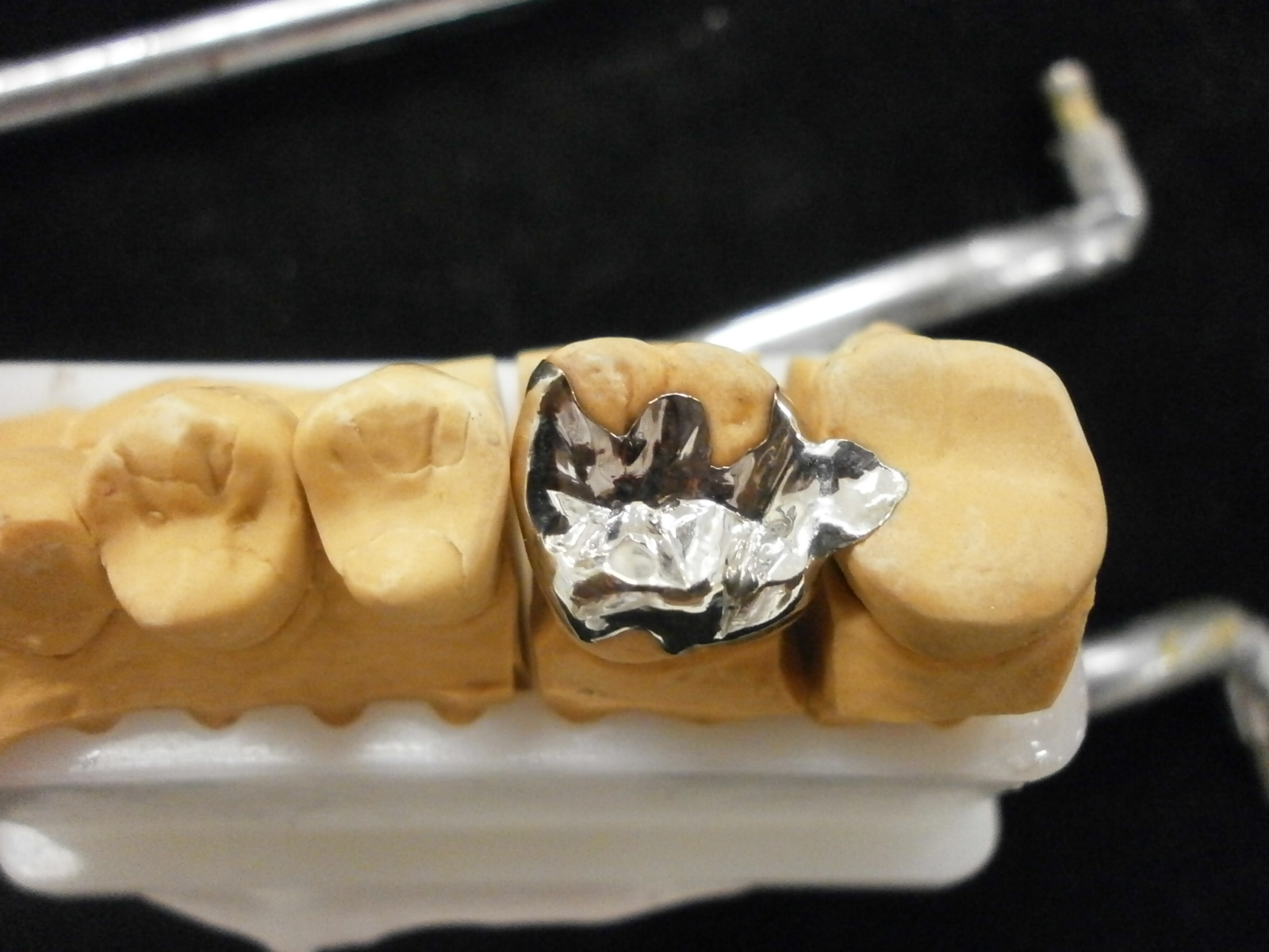 テーラーメイド歯科補綴修復物の紹介 Introduction of the tailor-maid dental prosthesis ...