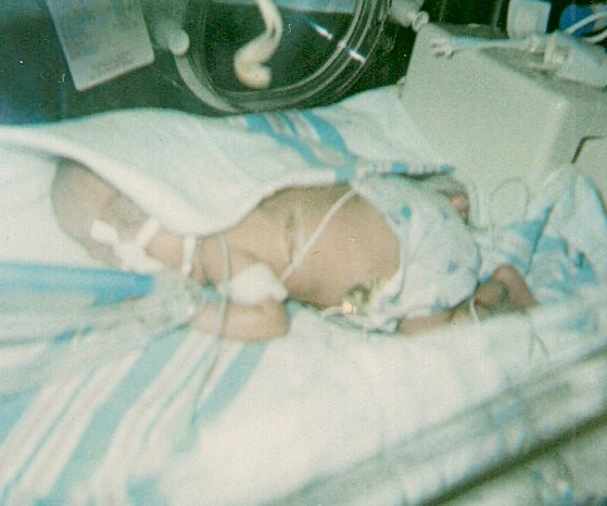 Kellisa's Path: PDA Ligation