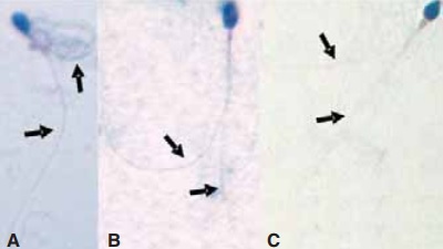 [Haematology] Atlas of Semen Analysis | Free Medical Atlas